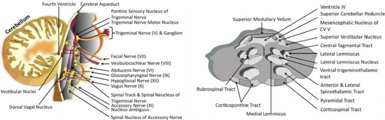 Diffuse Intrinsic Pontine Glioma: Past Perspectives and Future ...